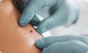 le centre - chirurgie-dermatologique-paris.fr